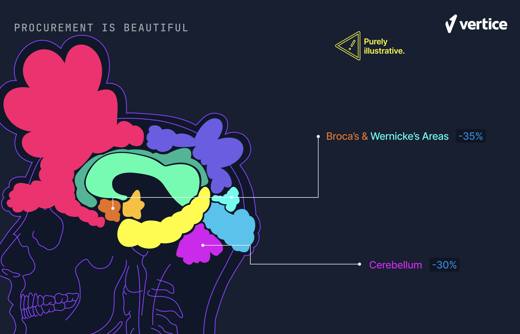 The "procurement brain" in 2050 | Vertice Blog